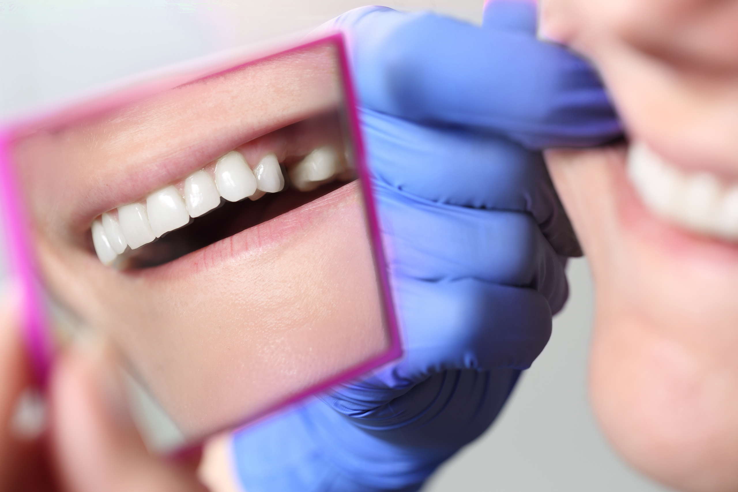 Gum & Jawbone Corrective Treatments - Prime Smile Dental Group